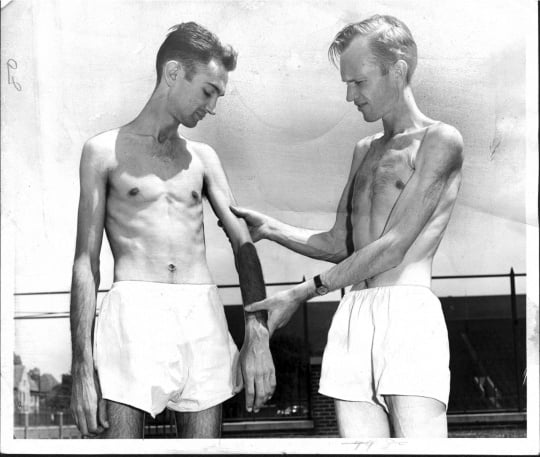 Starvation Experiment of Dr. Ancel Keys, 1944–1945 | MNopedia